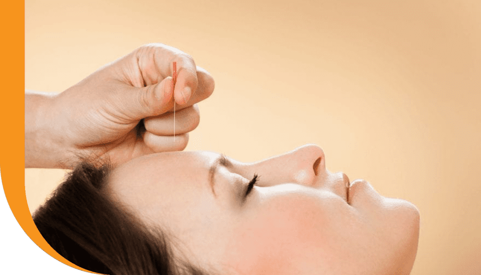 acupuncture services hamilton - Activa Clinics